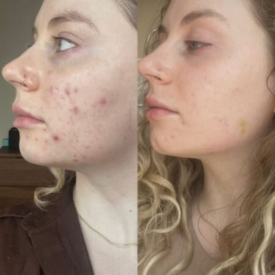 AO2 Clear - 8.4oz each – Staci Christie Skin